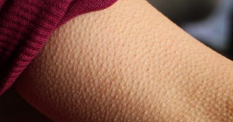If Music Gives You Goosebumps, Here’s What It May Say About Your Brain ...